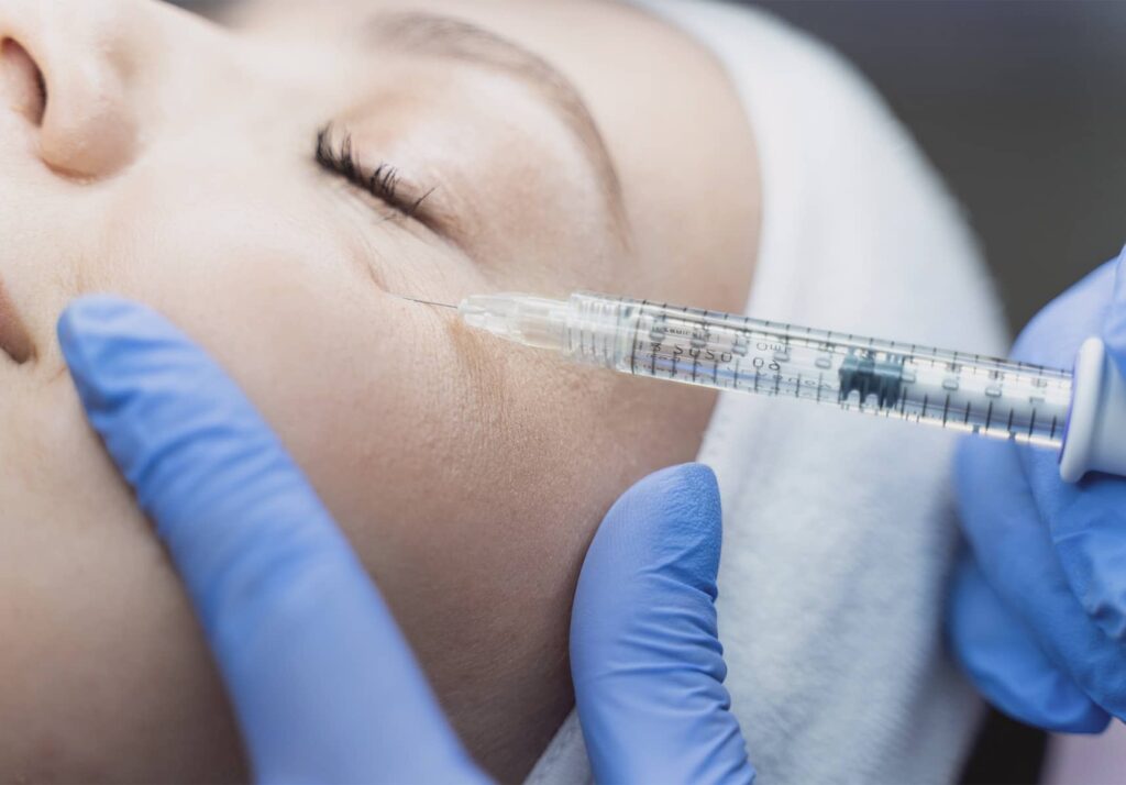 Traitement des cernes : injection acide hyaluronique | Paris | Dr Scemama