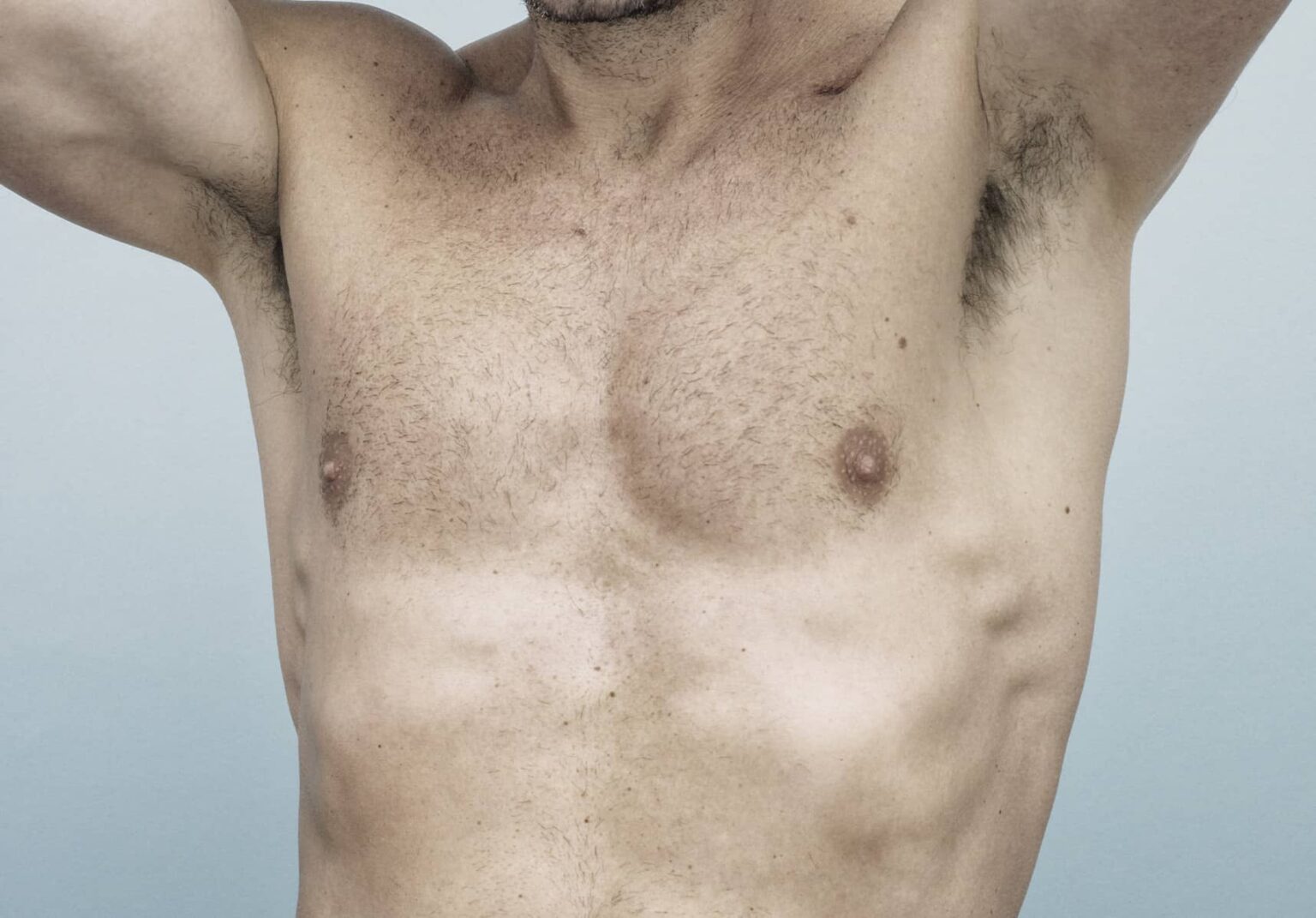 Épilation laser du torse : l'épilation pour homme | Paris | Dr Scemama